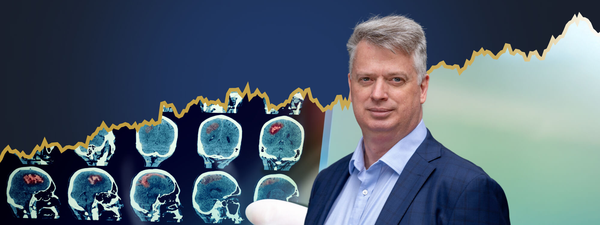 Telix eyes strong growth in 2025, but RFK Jr. poses a wildcard: Shane Fitzgerald - Vishal ...